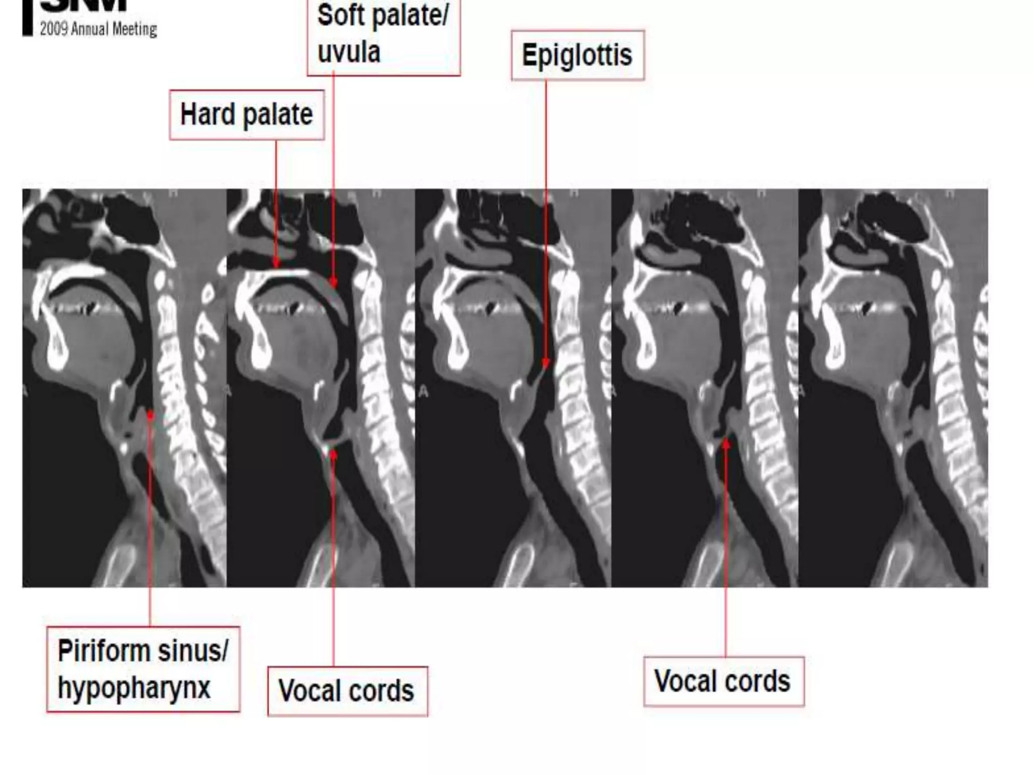 Ct ANATOMY HEAD AND NECK | PPTX