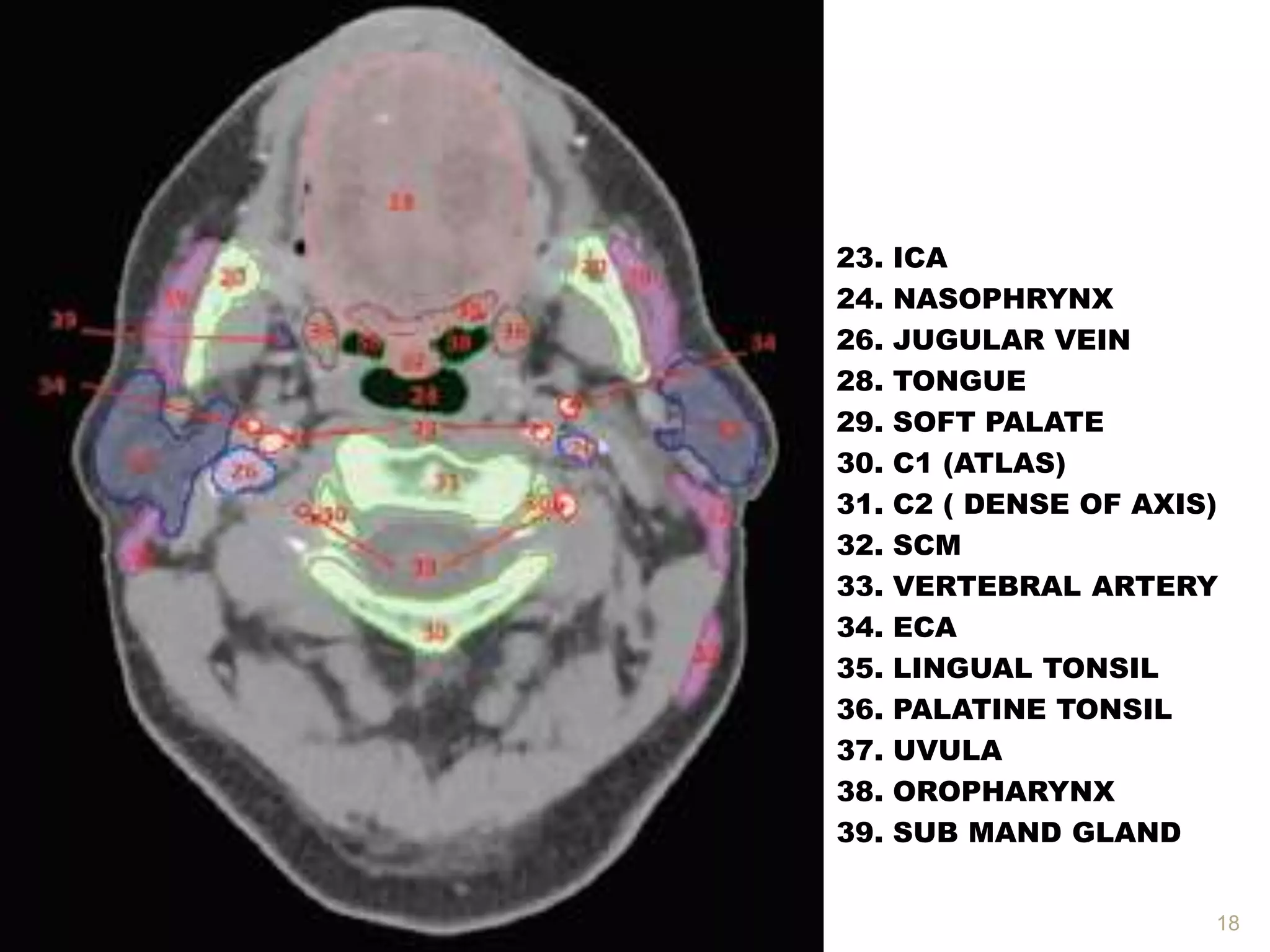 Ct ANATOMY HEAD AND NECK | PPTX