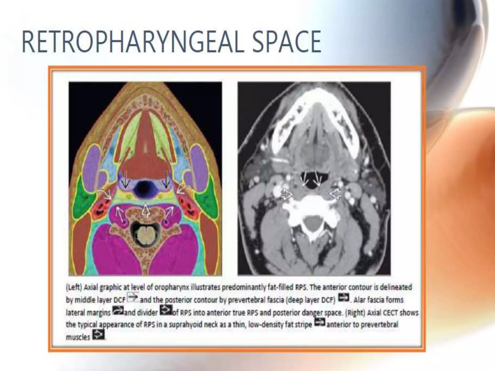 Ct ANATOMY HEAD AND NECK | PPTX