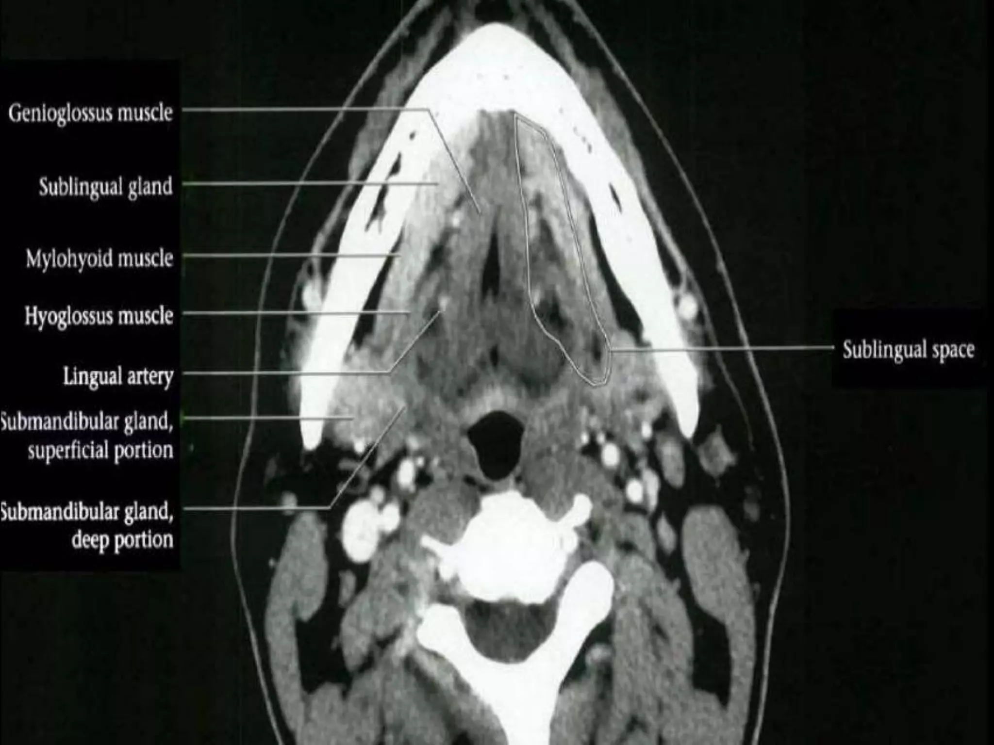 Ct ANATOMY HEAD AND NECK | PPTX