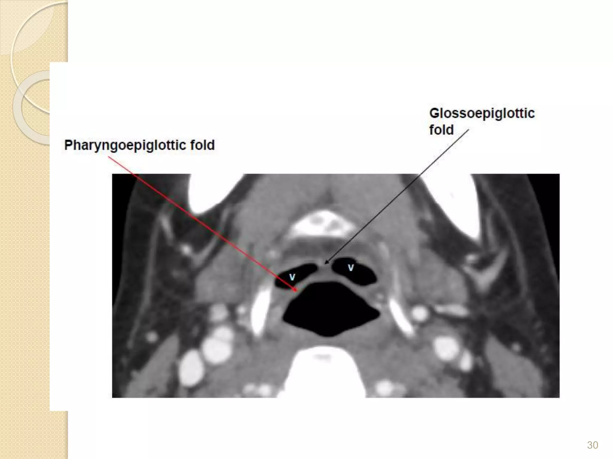 Ct ANATOMY HEAD AND NECK | PPTX