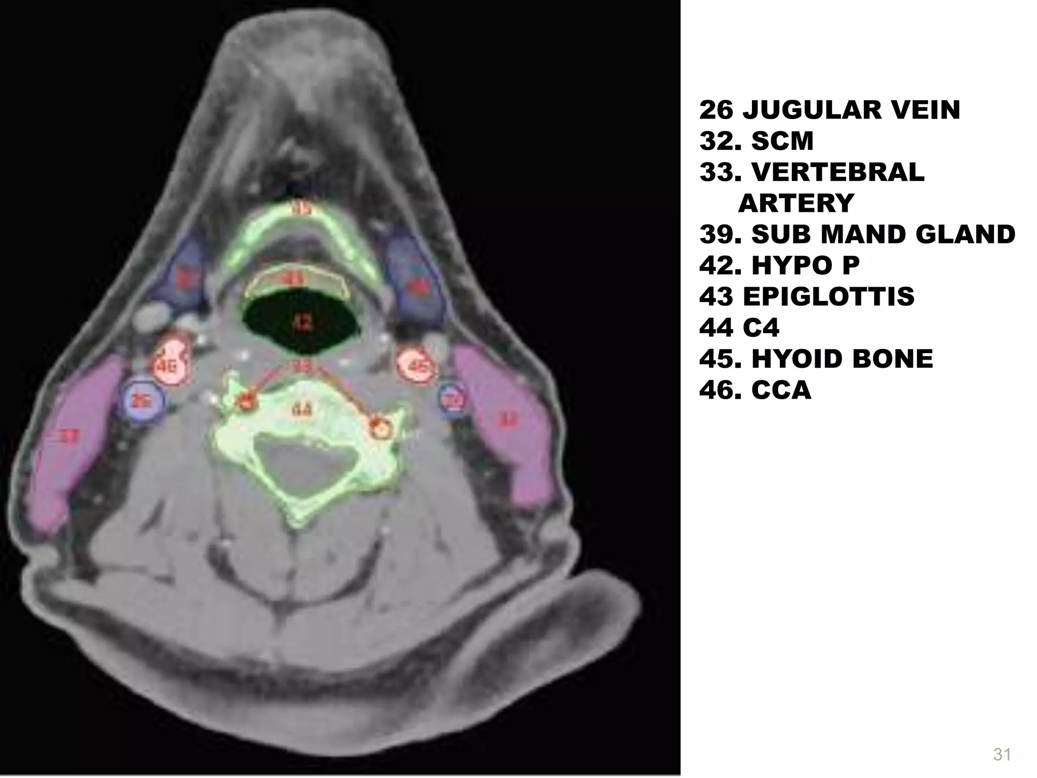 Ct ANATOMY HEAD AND NECK | PPTX