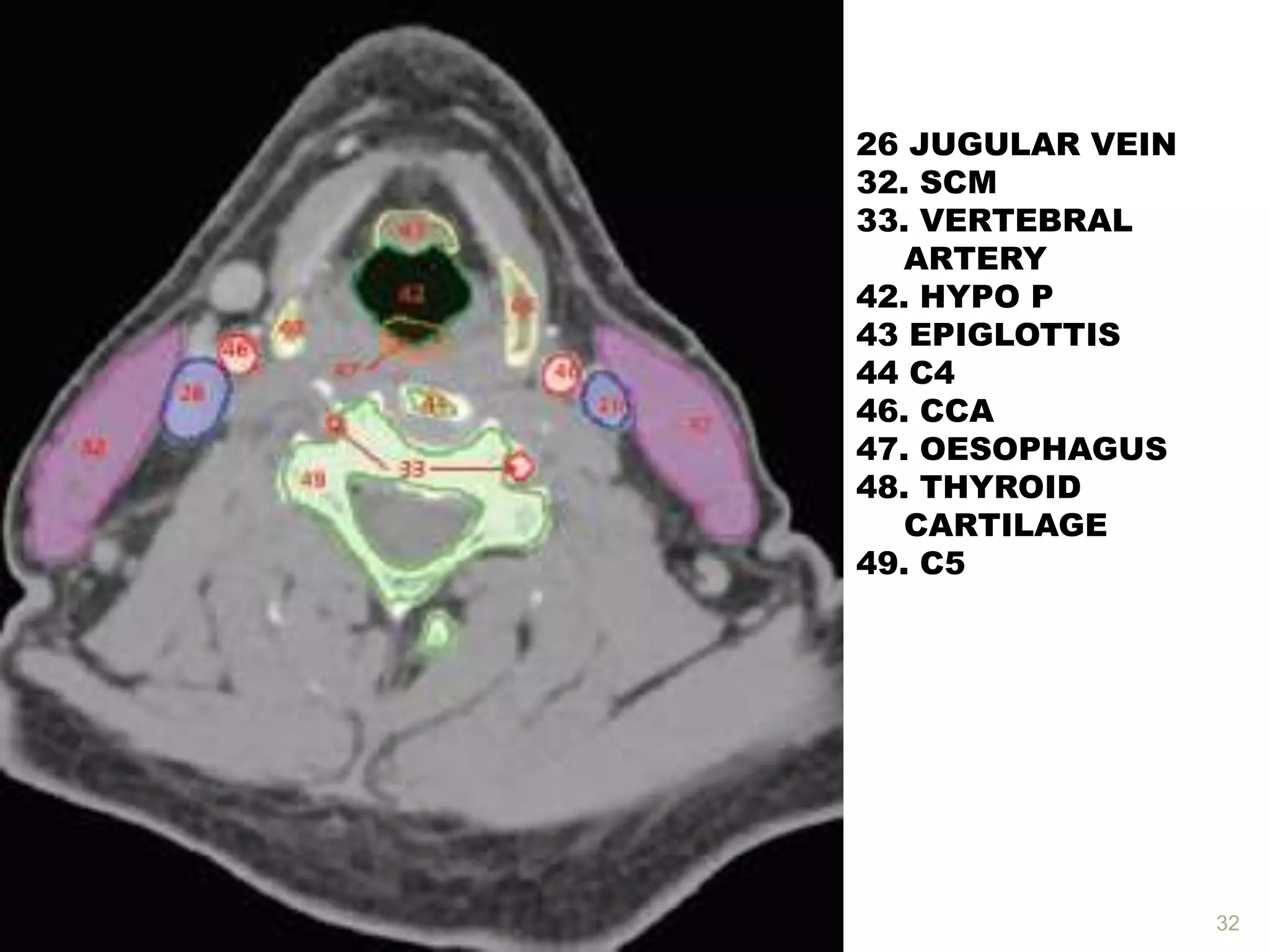 Ct ANATOMY HEAD AND NECK | PPTX
