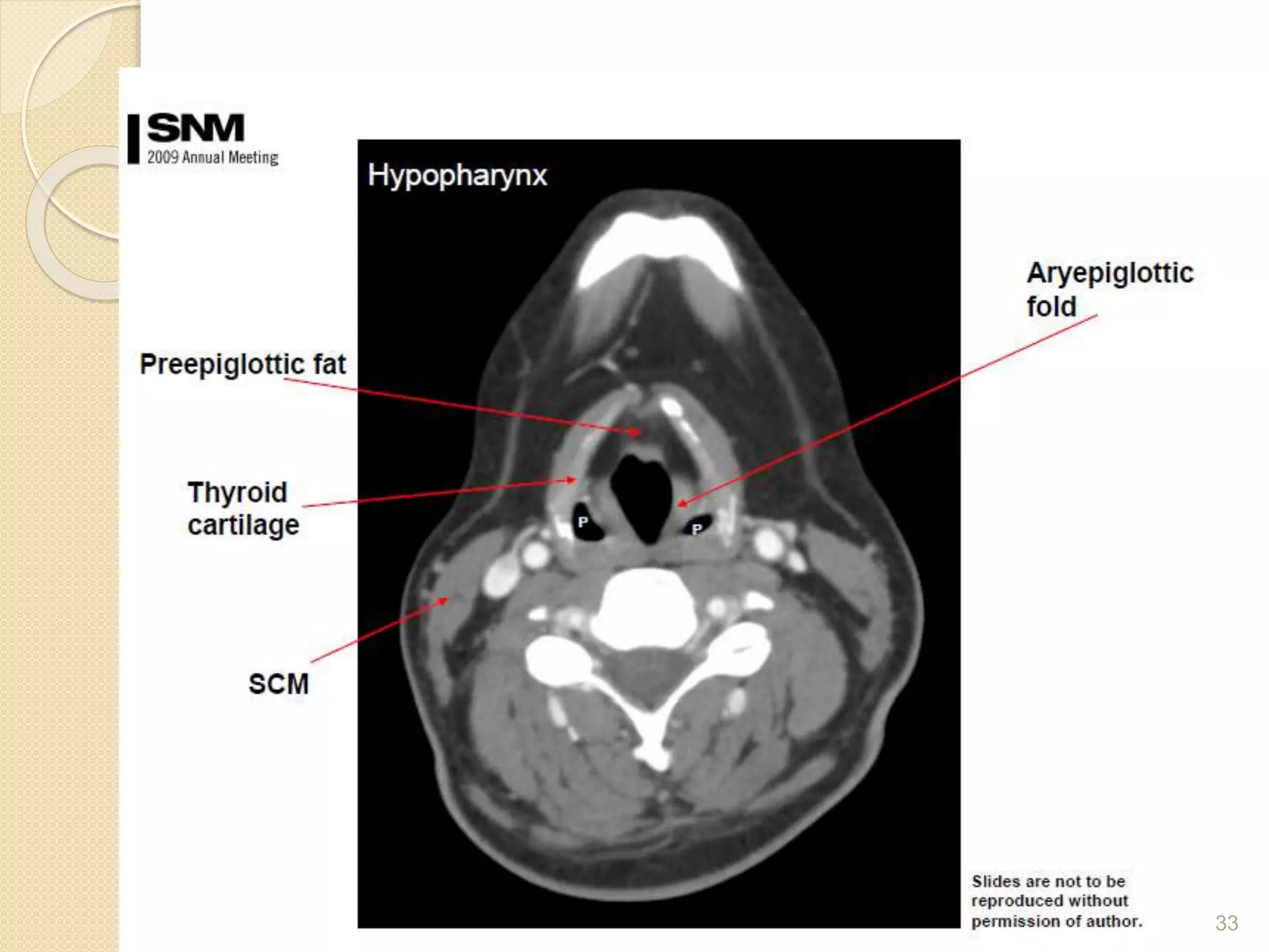 Ct ANATOMY HEAD AND NECK | PPTX