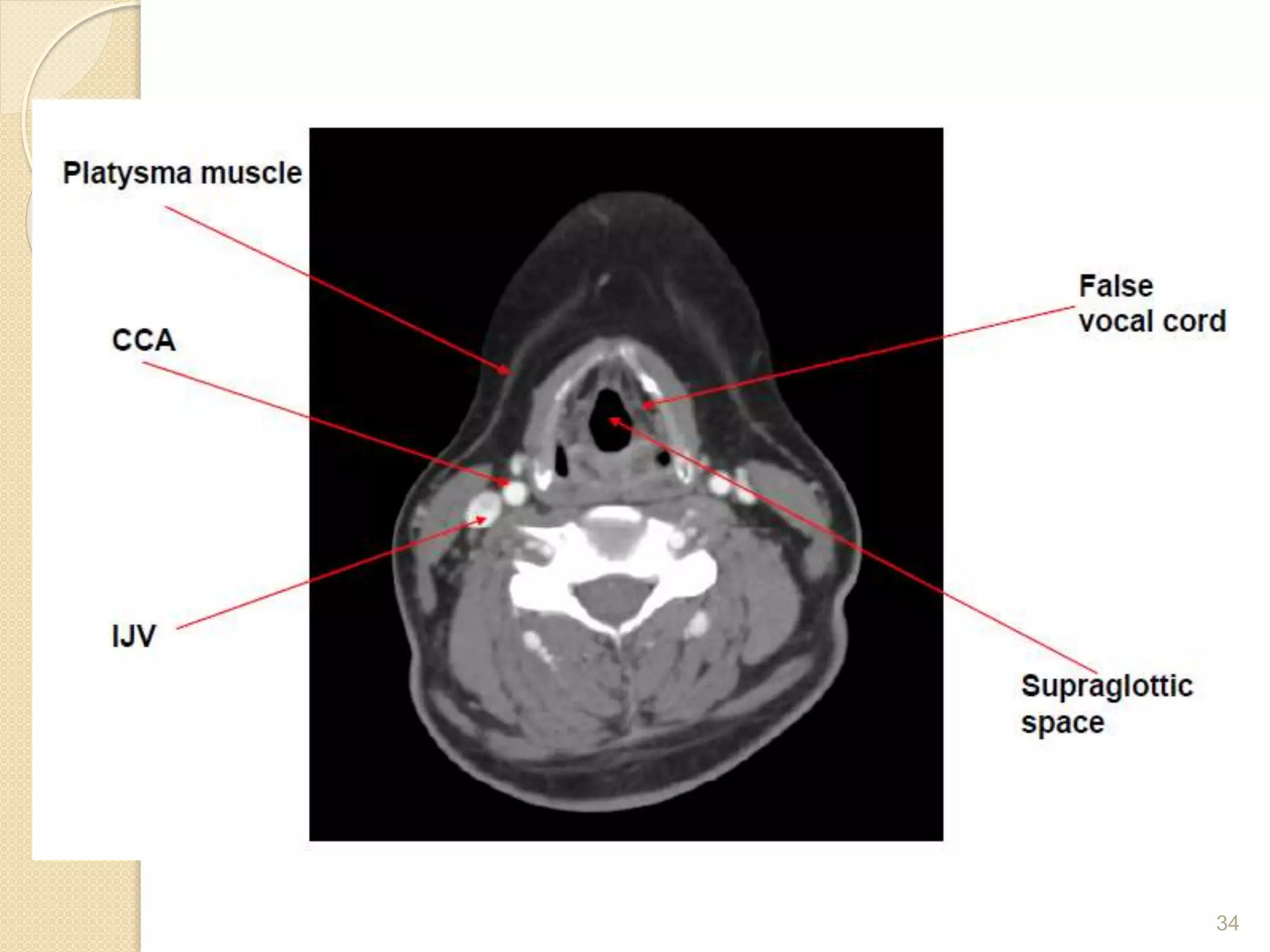 Ct Anatomy Head And Neck Ppt