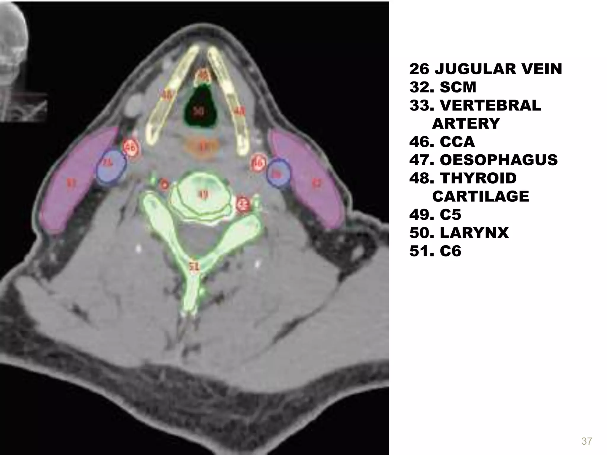 Ct ANATOMY HEAD AND NECK | PPTX