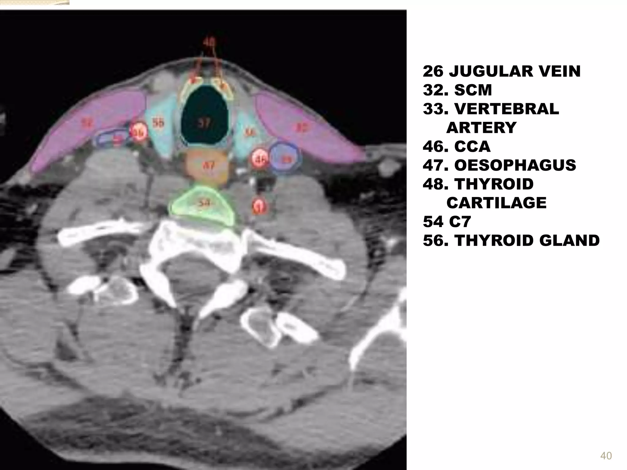 Ct ANATOMY HEAD AND NECK | PPTX