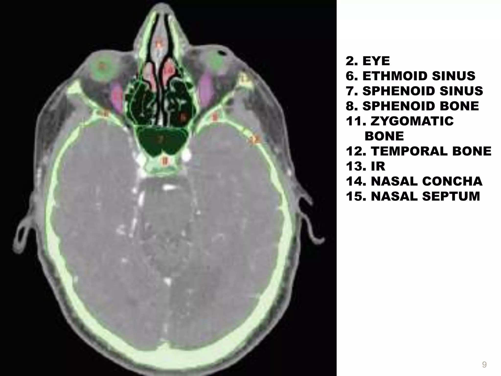 Ct ANATOMY HEAD AND NECK | PPTX