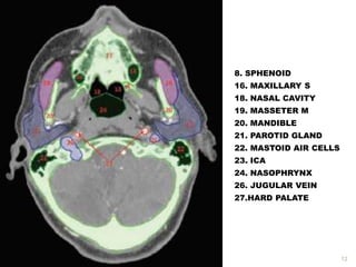 Ct ANATOMY HEAD AND NECK | PPTX