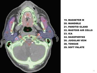 Ct ANATOMY HEAD AND NECK | PPTX