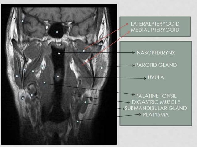 Ct ANATOMY HEAD AND NECK | PPTX