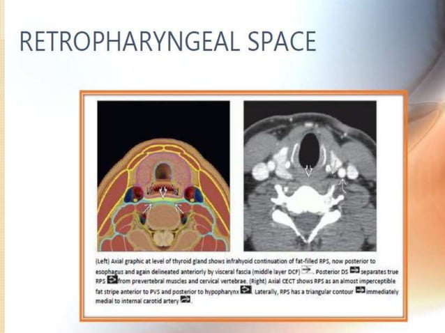 Ct ANATOMY HEAD AND NECK | PPTX