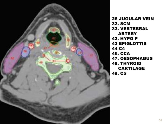 Ct ANATOMY HEAD AND NECK | PPTX