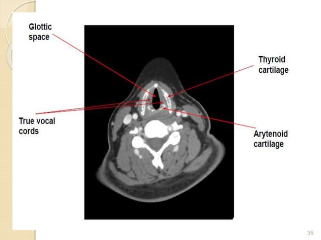 Ct ANATOMY HEAD AND NECK | PPTX