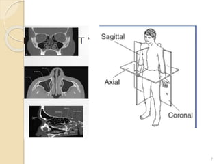 Ct ANATOMY HEAD AND NECK | PPTX