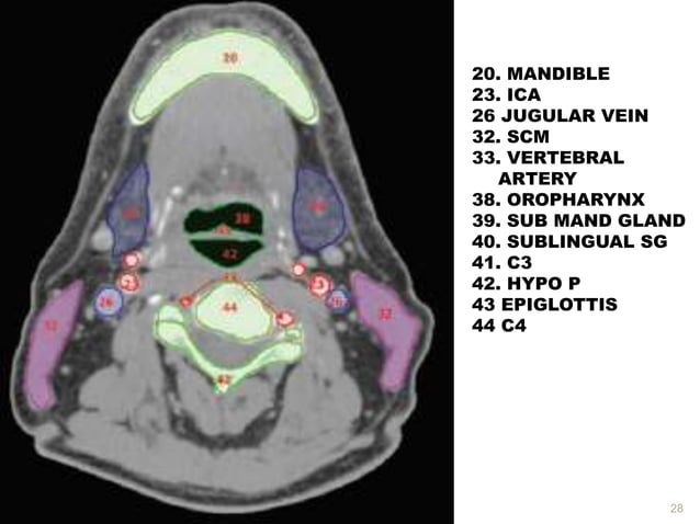 Ct Anatomy Head And Neck