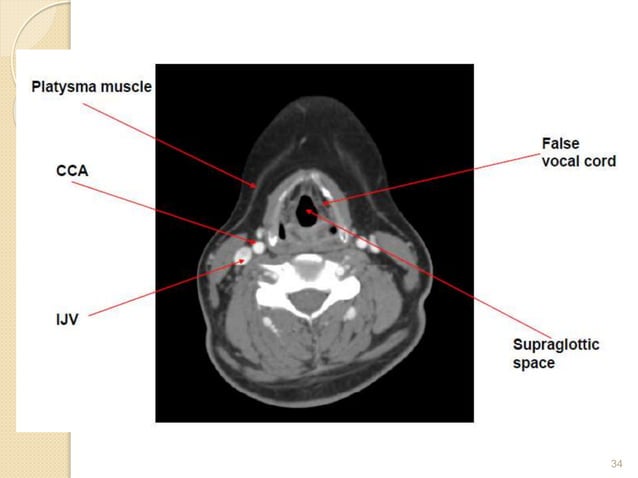 Ct Anatomy Head And Neck