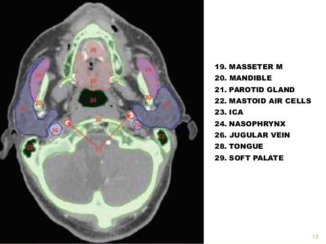 Ct Anatomy Head And Neck