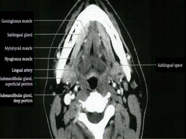 Ct Anatomy Head And Neck
