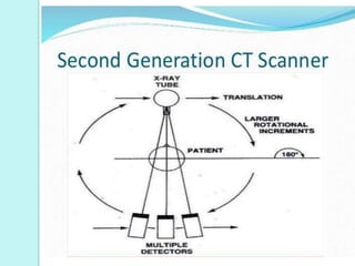 computed Tomography | PPTX