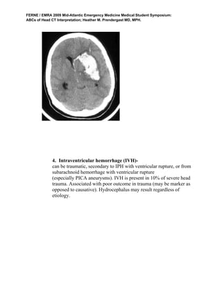 Ct brain | PDF