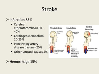 CT in CVA | PPTX