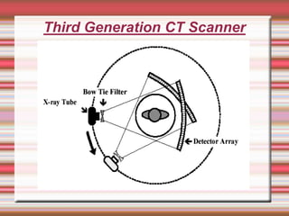 CT- GENERATIONS.ppt