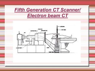 CT- GENERATIONS.ppt