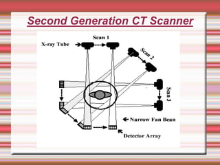 CT- GENERATIONS.ppt