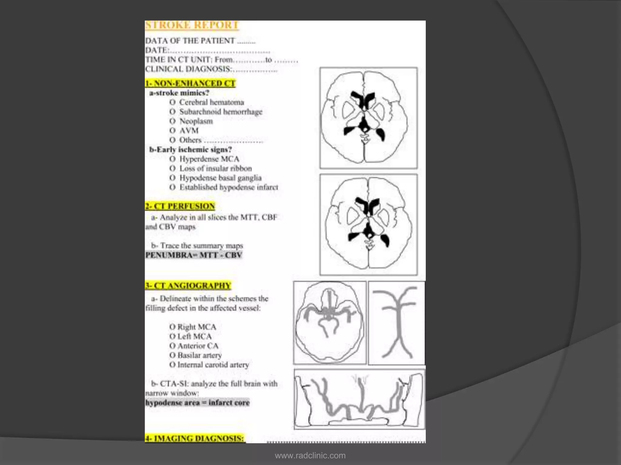 C T Imaging Of Acute Stroke Ppt Free Download