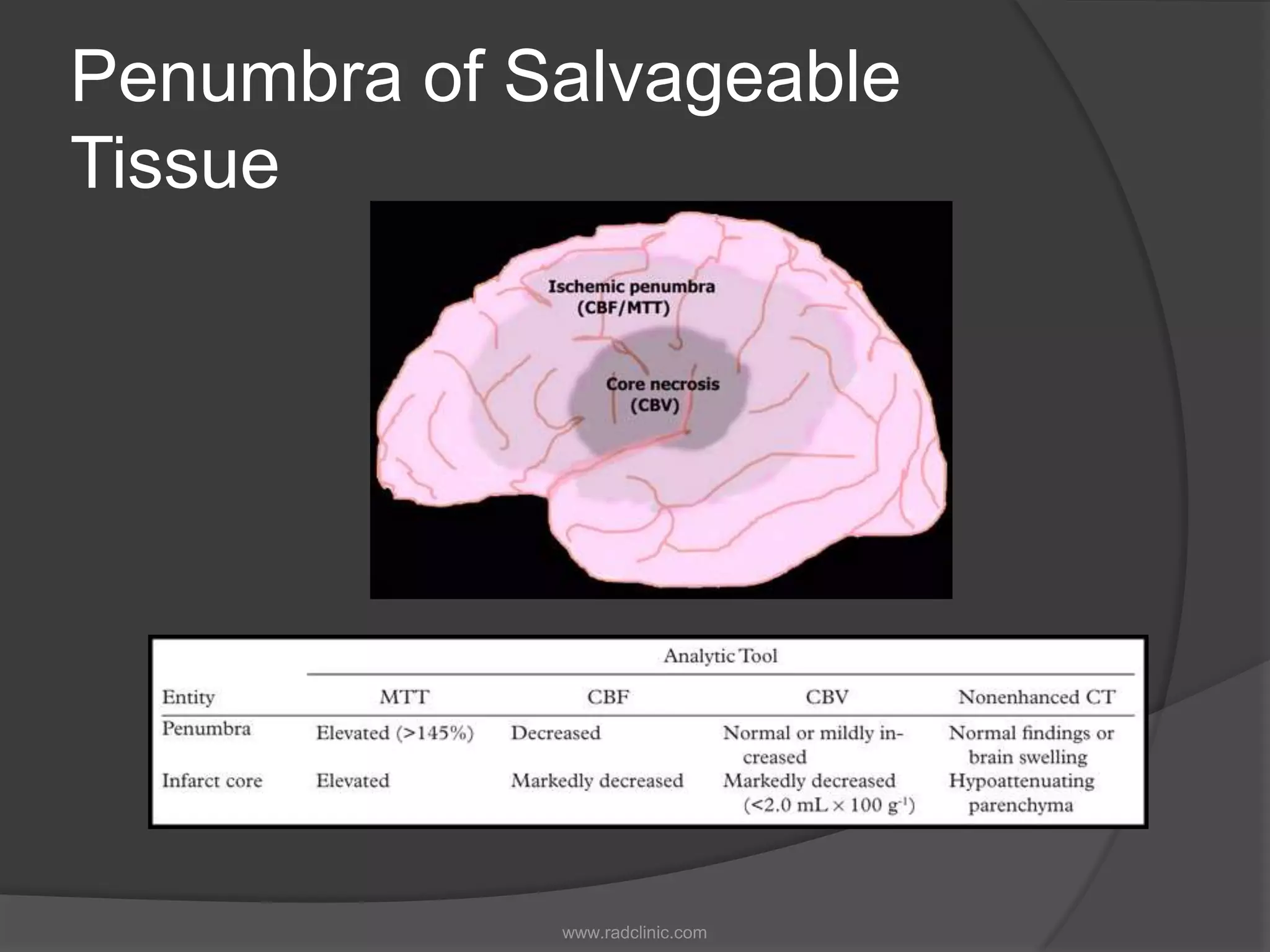 C T Imaging Of Acute Stroke Ppt Free Download