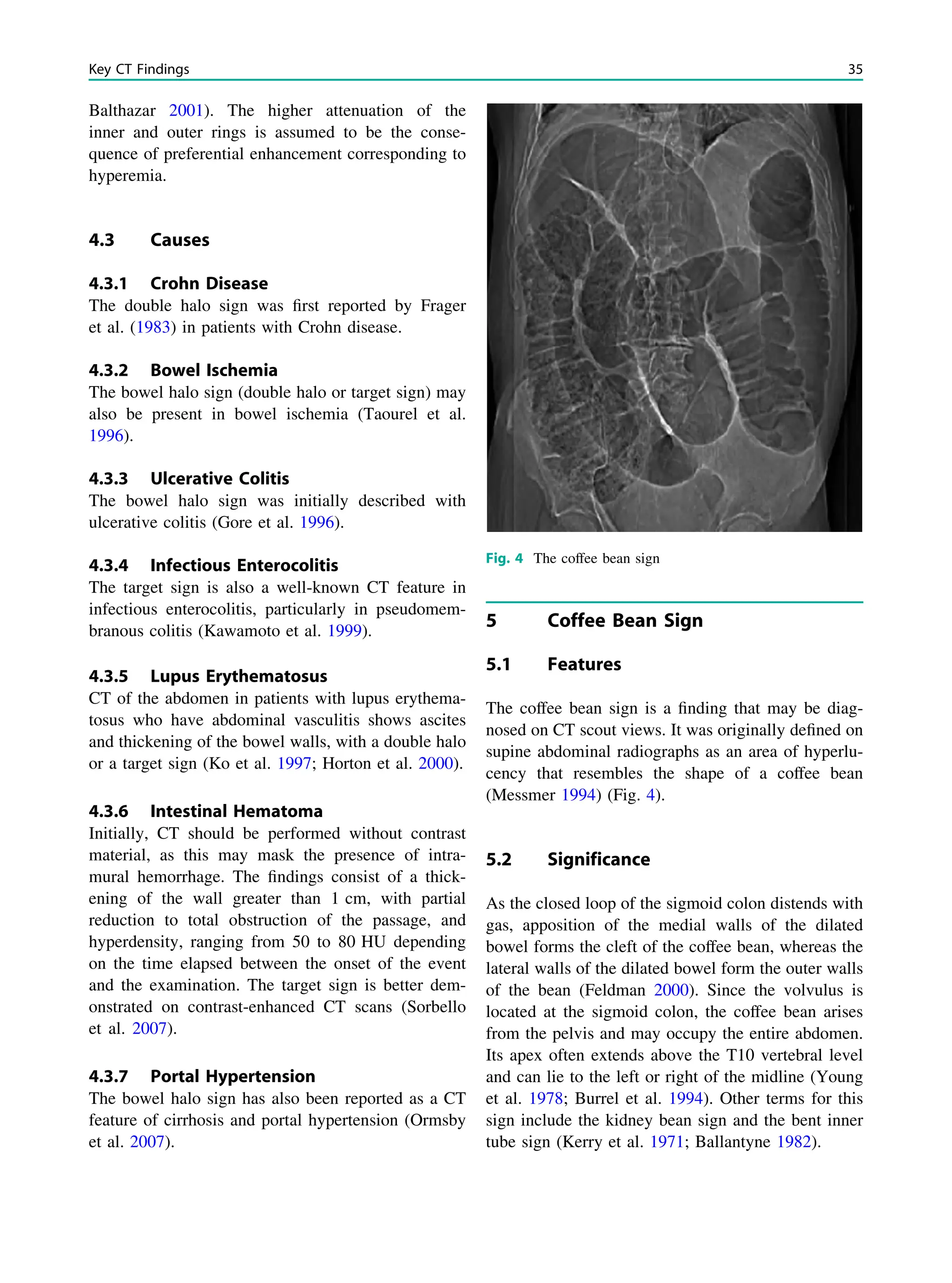 ct-of-the-acute-abdomen_compress (2).pdf