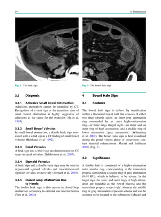 ct-of-the-acute-abdomen_compress (2).pdf