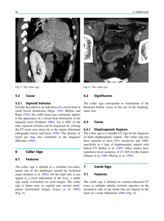 ct-of-the-acute-abdomen_compress (2).pdf