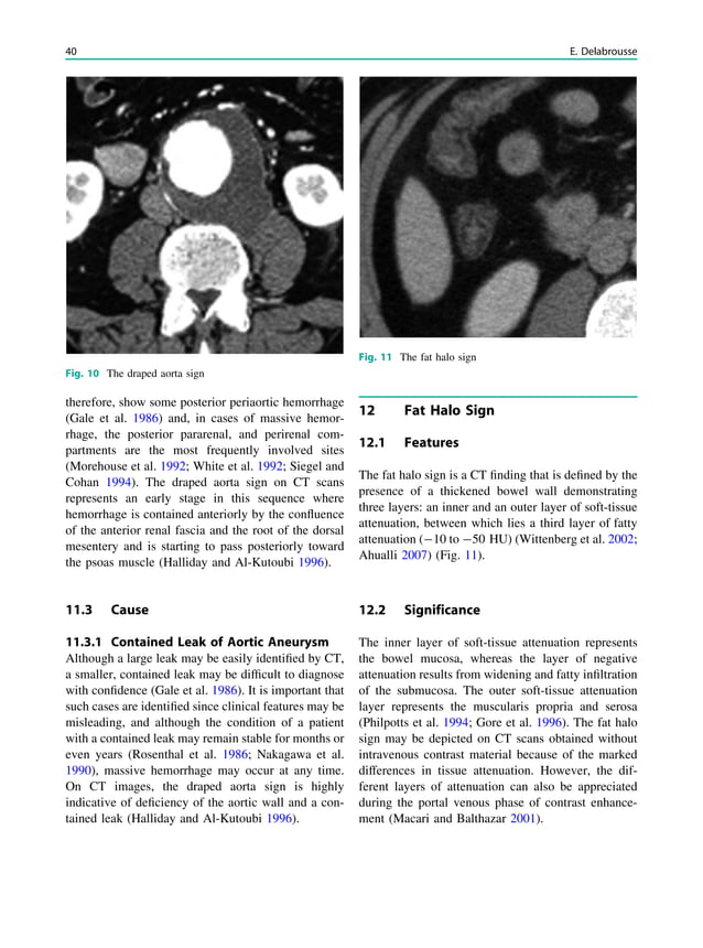 ct-of-the-acute-abdomen_compress (2).pdf