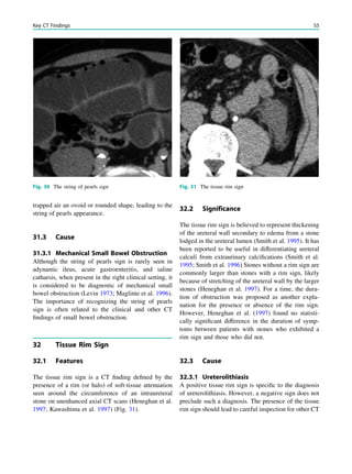 ct-of-the-acute-abdomen_compress (2).pdf