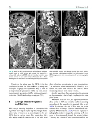 ct-of-the-acute-abdomen_compress (2).pdf