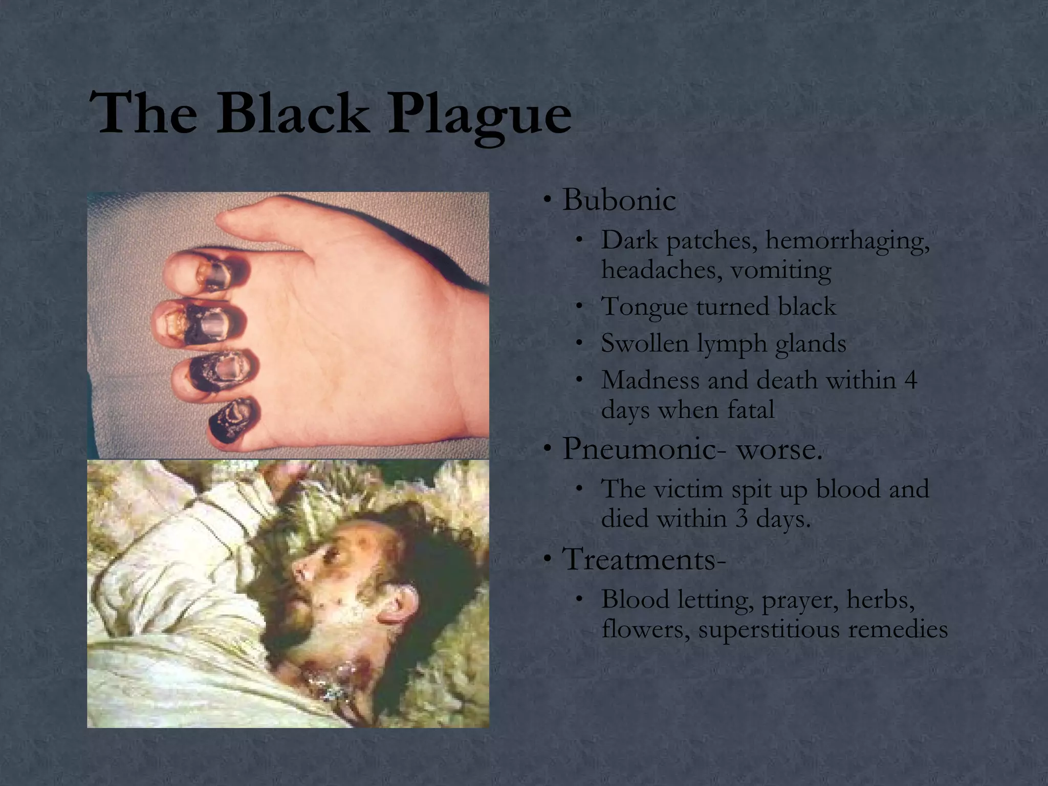Medieval plagues and medicine | PPT