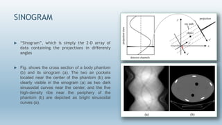 CT Image Reconstruction- Avinesh Shrestha | PPTX