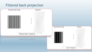 CT Image Reconstruction- Avinesh Shrestha | PPTX