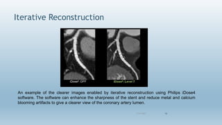 CT Image Reconstruction- Avinesh Shrestha | PPTX