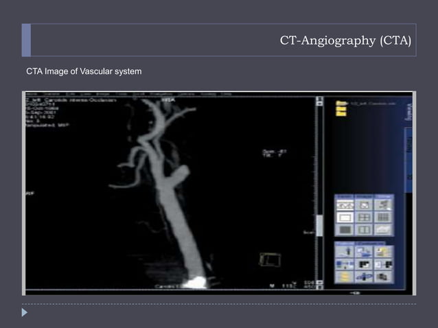 CT scan | PPT