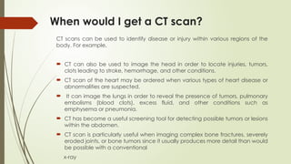 CT-Scan (1).pptxCT-Scan (1).pptxCT-Scan (1).pptxCT-Scan (1).pptx