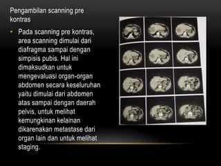 ppt Ct scan abdomen pada kasus kista liver | PPTX