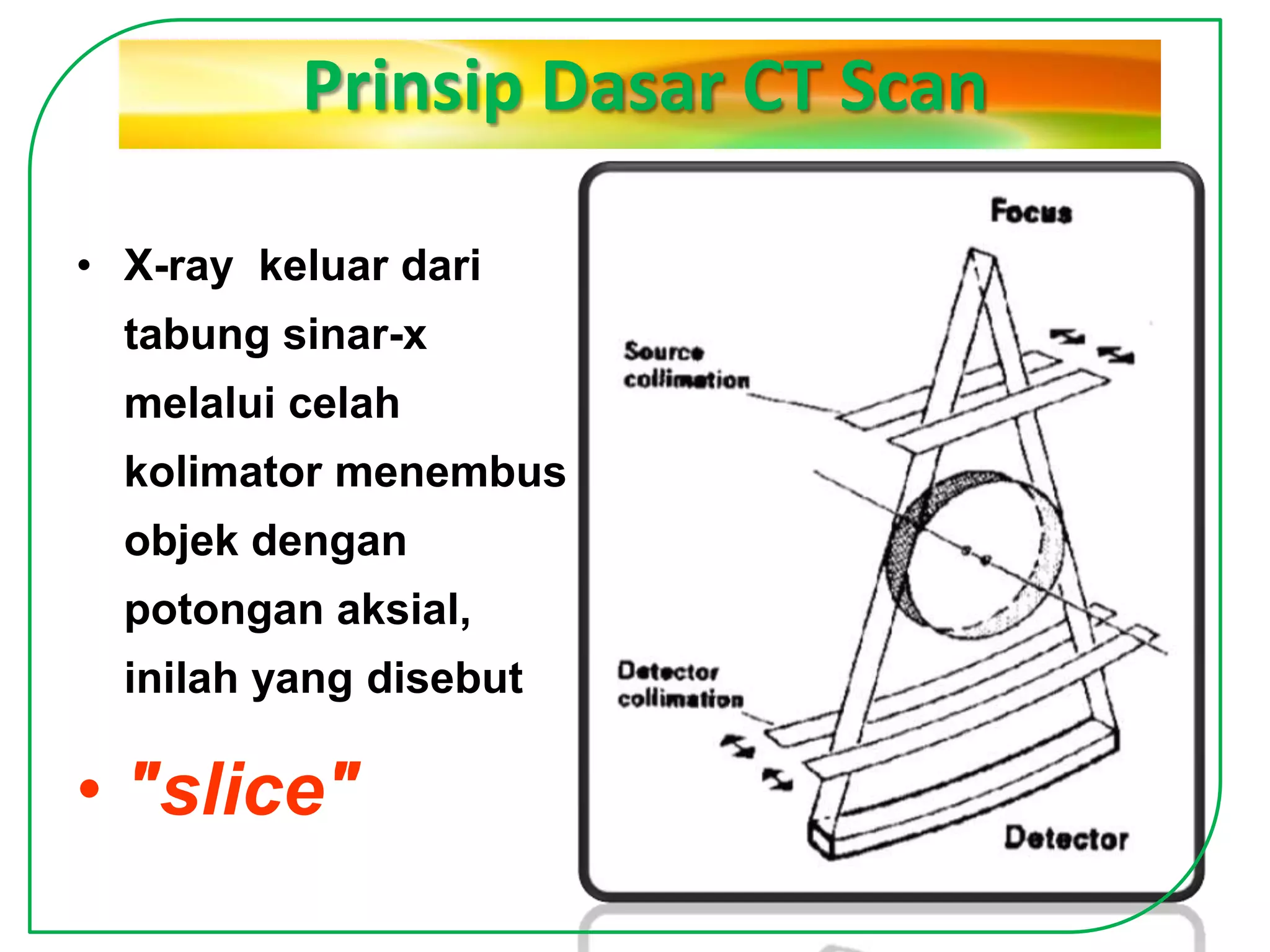 Ct scan kel viii | PDF