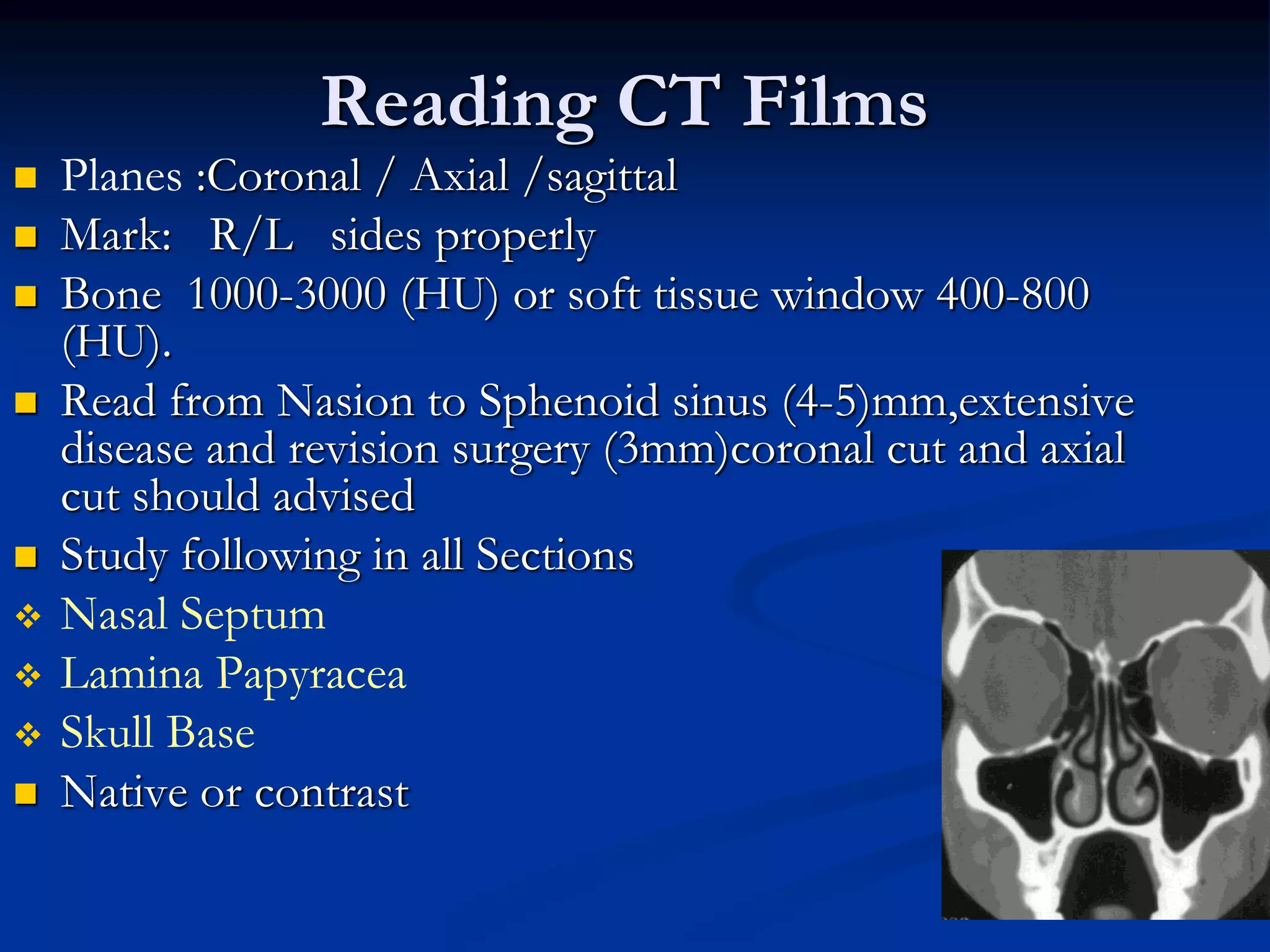 CT scan of nose and PNS | PPT