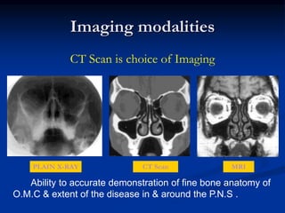 CT scan of nose and PNS | PPT