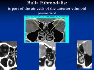 CT scan of nose and PNS | PPT