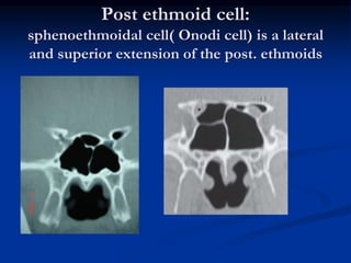 CT scan of nose and PNS | PPT