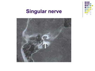 Ct scan of temporal bone 2nd lecture | PPT